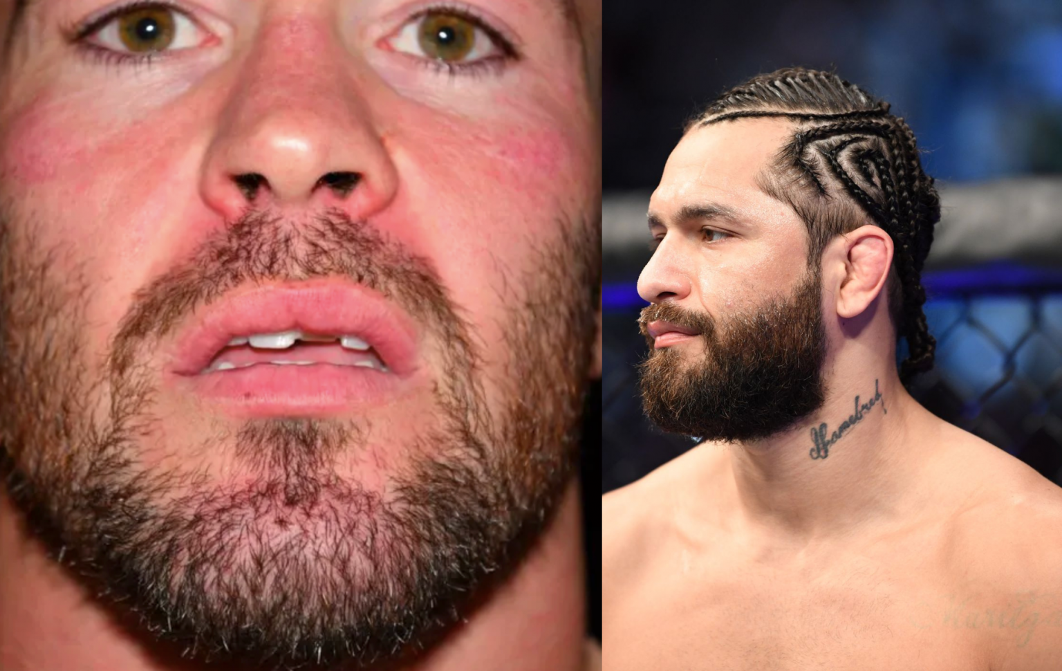 Pictures Reveal Colby Covington's Chipped Tooth Caused by Jorge ...